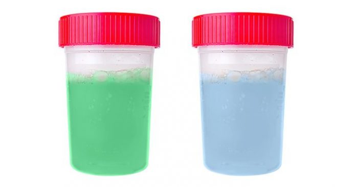 El color de tu orina dice todo sobre tu salud – Salud Chicas